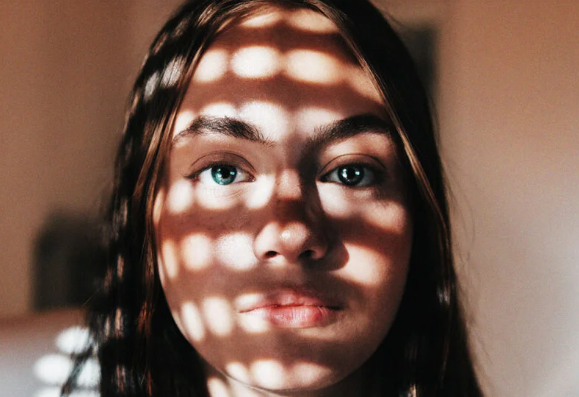 Photosensitivity (Sensitivity to Sunlight) Symptoms & Impact in ...