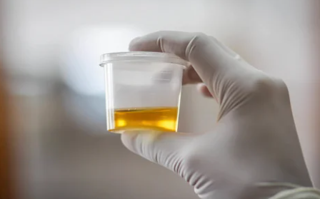 Silent Signals: Is Urine Retention a Fibromyalgia Red Flag? Discover ...