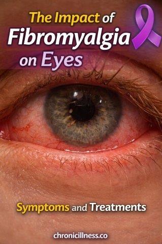 The Impact of Fibromyalgia on the Eyes: Symptoms, Sensations, and Paths ...