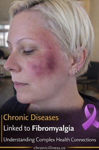 Chronic Diseases Linked to Fibromyalgia: Understanding Complex Health ...