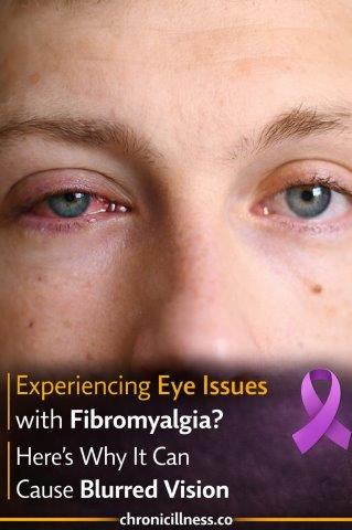 Experiencing Eye Issues with Fibromyalgia? Here Is Why It Can Cause ...