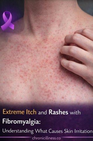 Extreme Itch and Rashes with Fibromyalgia: Understanding What Causes ...
