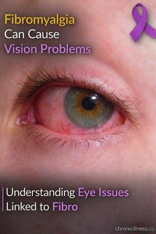 Fibromyalgia Can Cause Vision Problems and Why Eye Issues Are a Real ...