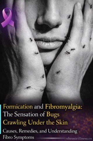 Formication and Fibromyalgia: The Sensation of Bugs Crawling Under the Skin