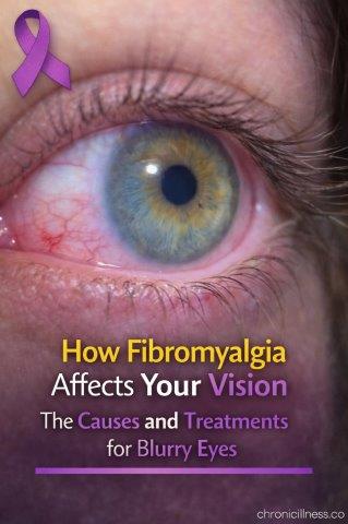 How Fibromyalgia Affects Your Vision: The Causes and Treatments for ...