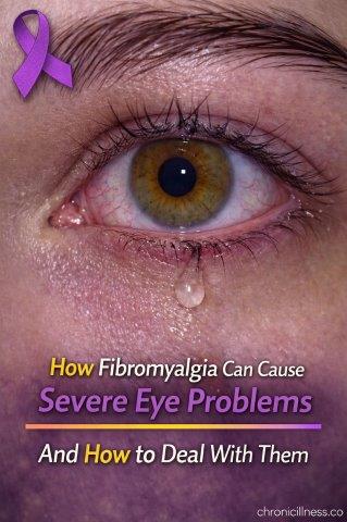 How Fibromyalgia Can Cause Severe Eye Problems and How to Deal With Them
