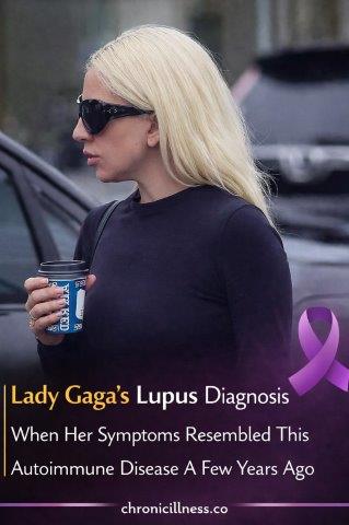 Lady Gaga’s Lupus Diagnosis: When Her Symptoms Resembled an Autoimmune ...