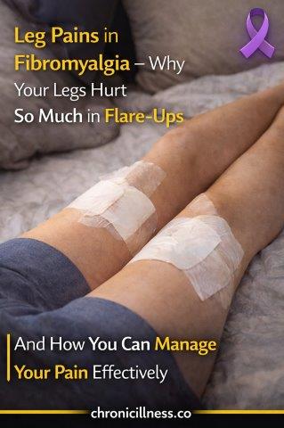 Leg Pains in Fibromyalgia: Why Your Legs Hurt So Much in Flare Ups and ...