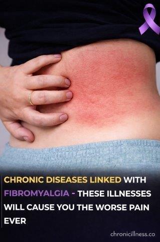 Chronic Diseases Linked With Fibromyalgia – These Overlapping ...
