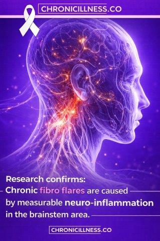 Fibromyalgia Flares and Neuro-Inflammation