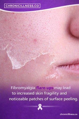 Fibromyalgia Skin Peeling