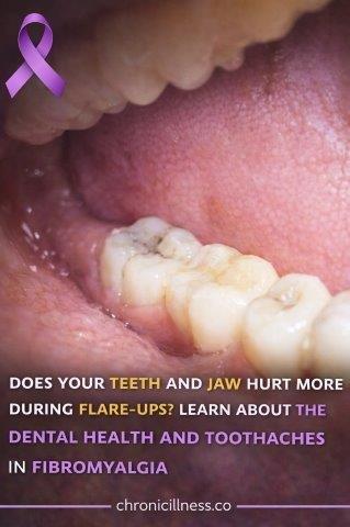 Fibromyalgia and Tooth Pain: Why Teeth and Jaw Hurt More During Flare-Ups