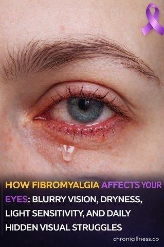 How Fibromyalgia Affects Your Eyes: Blurry Vision, Dryness, Light ...