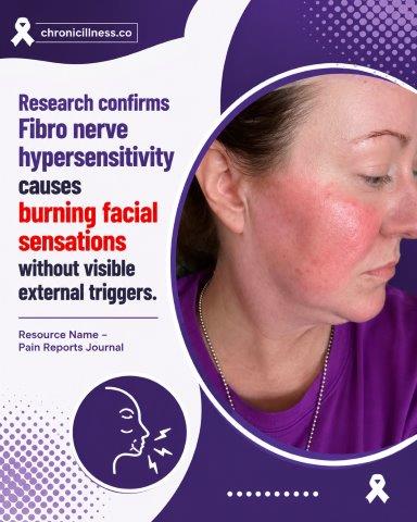 Burning Facial Sensations in Fibromyalgia