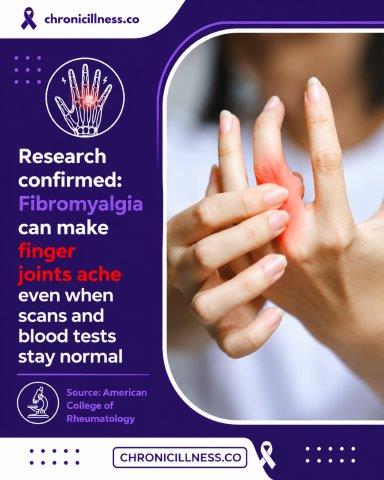 Fibromyalgia Finger Joint Pain