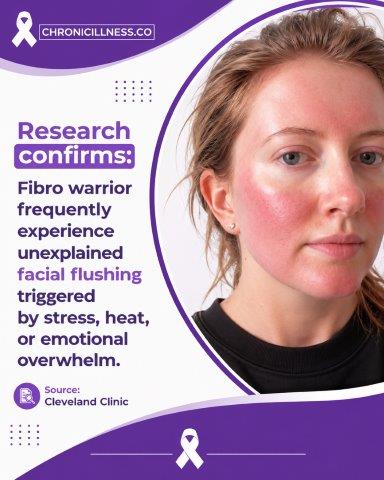 Fibromyalgia and Facial Flushing