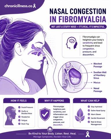 Nasal Congestion in Fibromyalgia