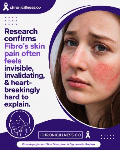 Fibromyalgia Skin Pain Feels Invisible Invalidating